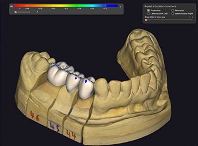 Odontología CAD/CAM